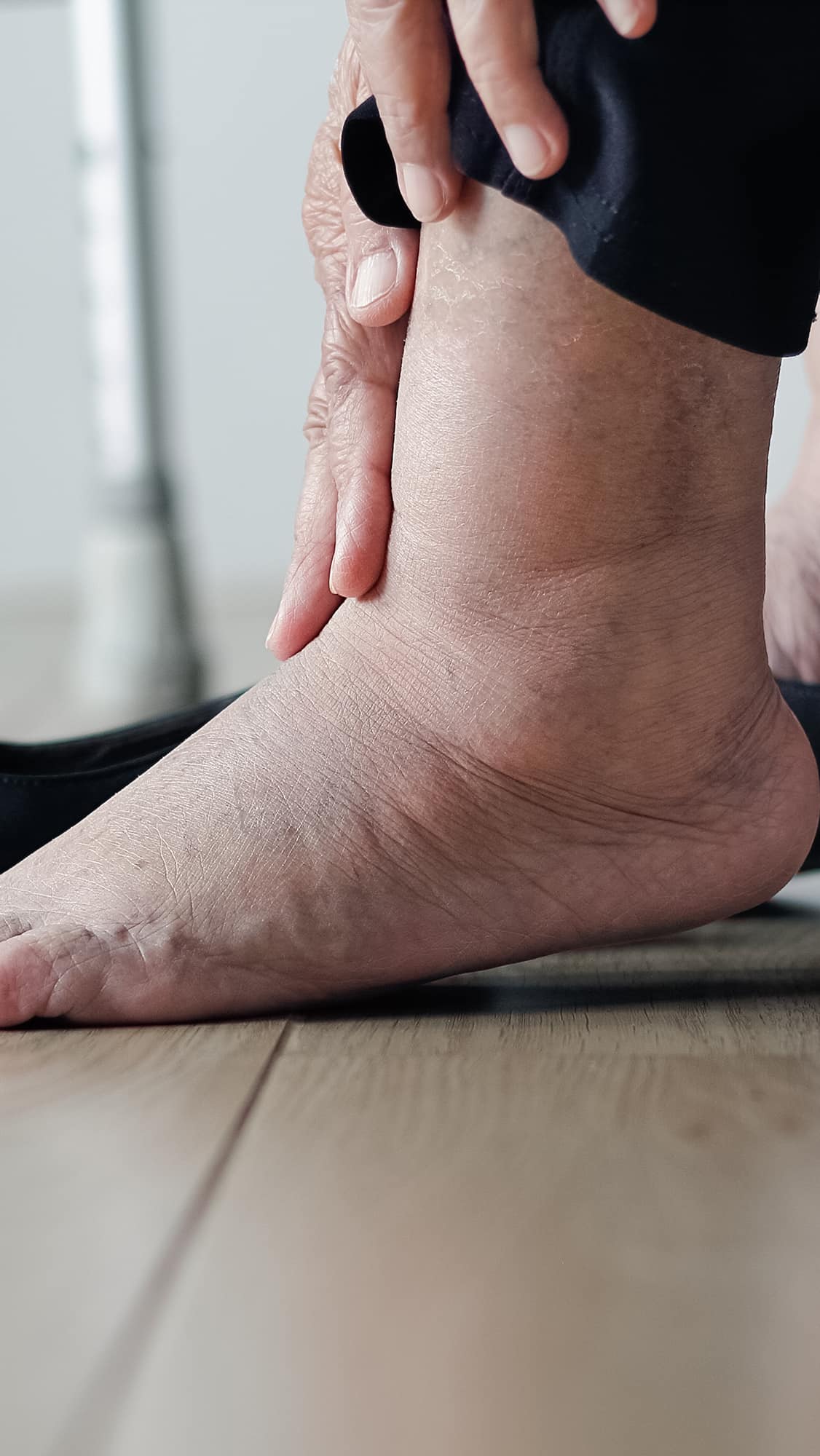 Swelling Feet Liver Failure - Infoupdate.org