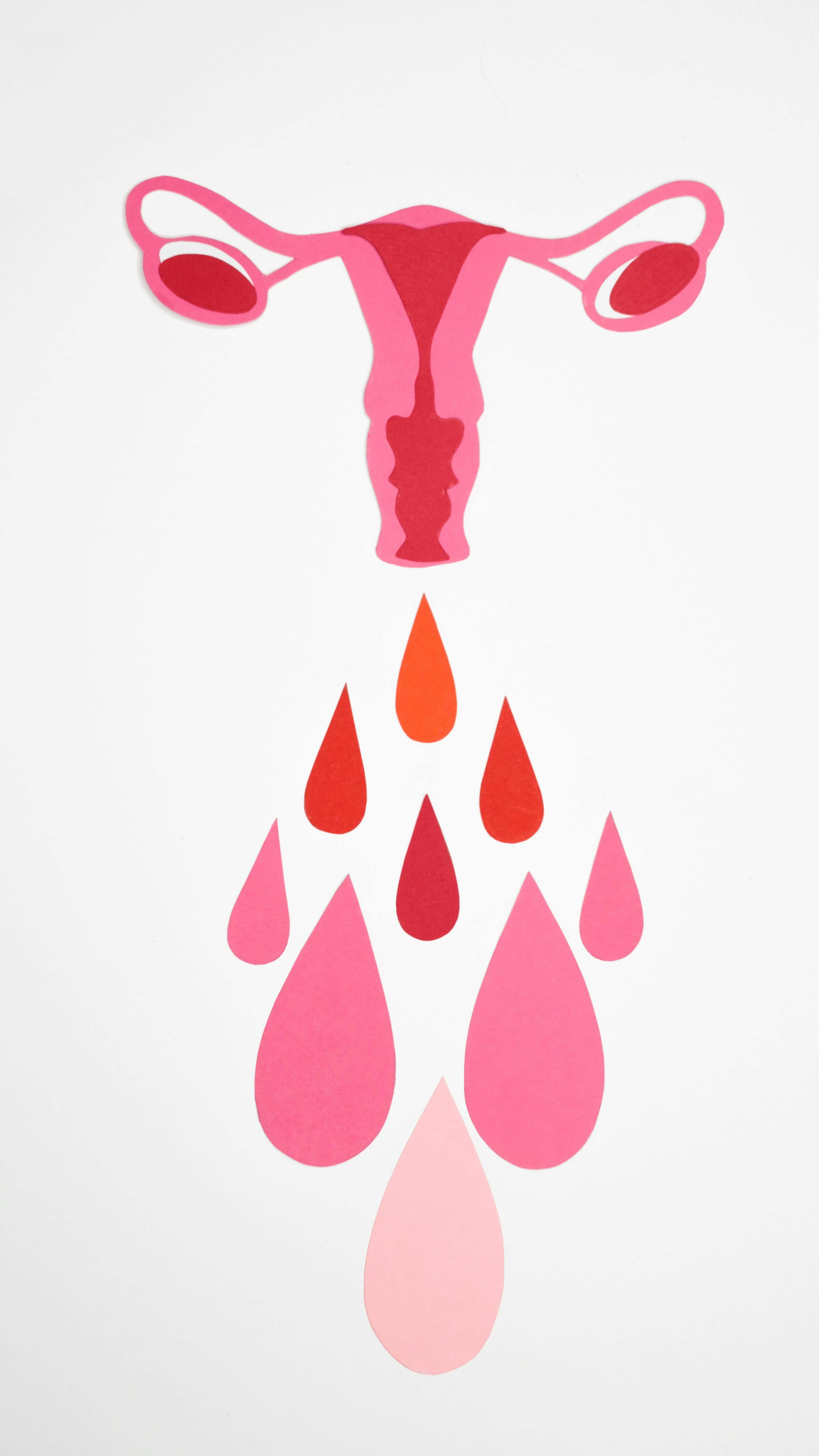 6 Myths About PCOS And Why They Are Wrong